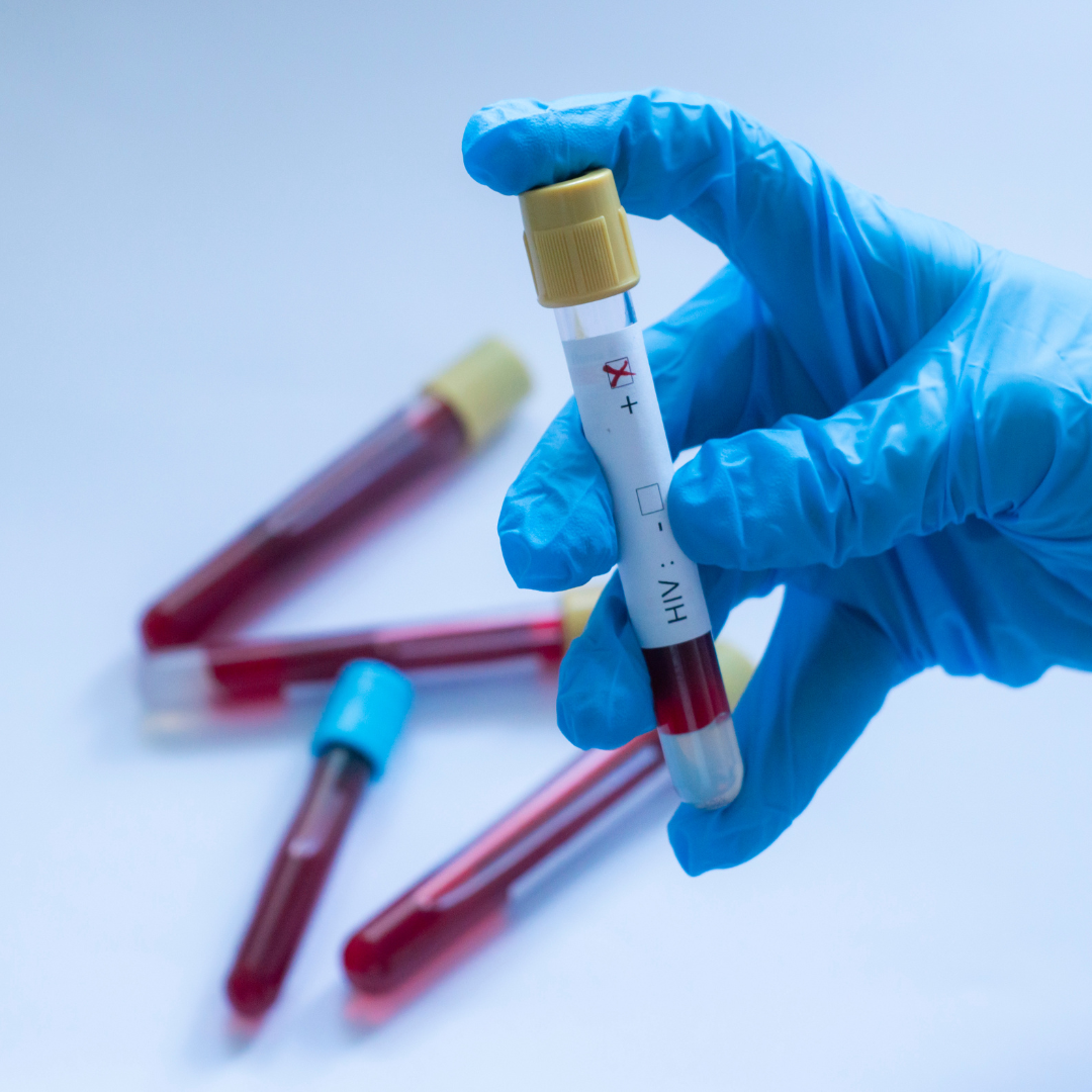 What Is The Window Period For An HIV Test? - Harmony Healthcare
