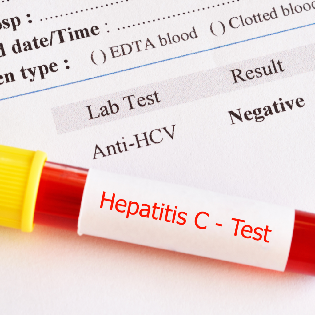 What Type of Doctor Treats Hep C?- Harmony Healthcare